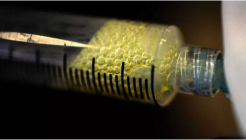 干细胞疗法发展历程_凤凰网健康_凤凰网