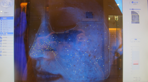 什么是VISIA？你真的了解VISIA皮肤检测吗？__凤凰网