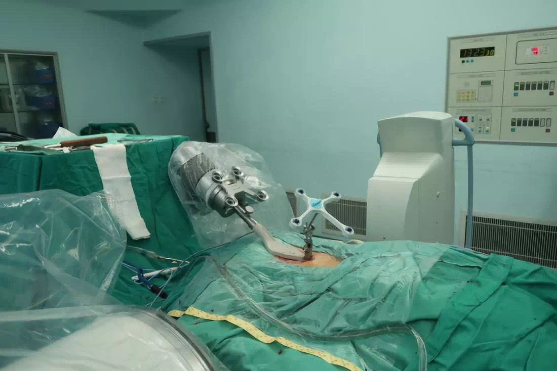 北京朝阳医院骨科完成首例天玑机器人辅助MIDLF微创手术__凤凰网